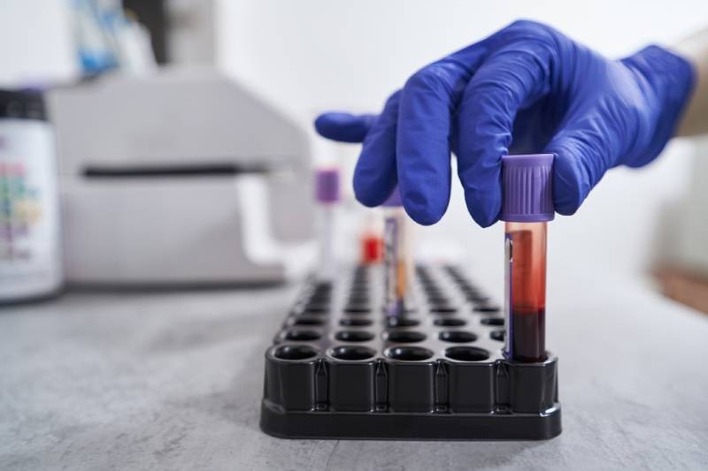 Groupe sanguin : tableau et comment le connaître | Charles.co