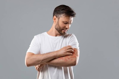 Teigne : symptômes, traitements et durée de contagion | Charles.co