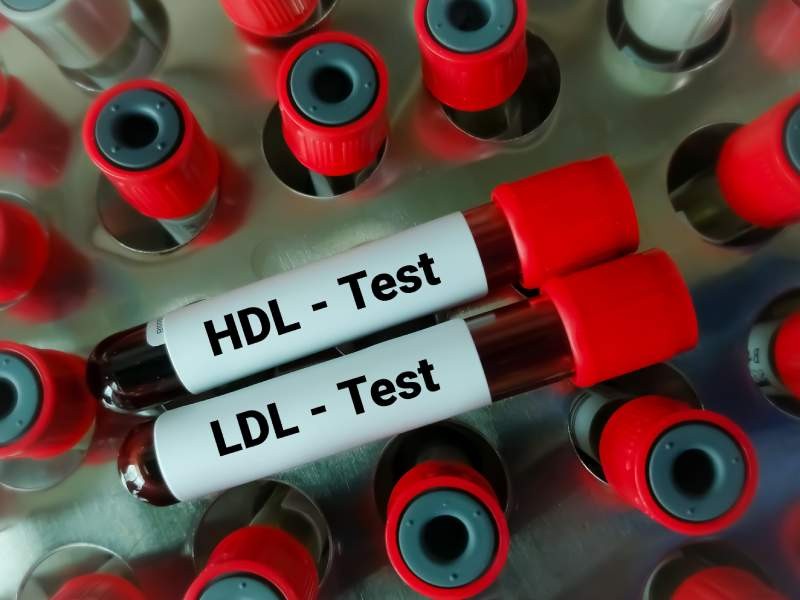 Cholestérol LDL : définition, haut, bas, que faire | Charles.co