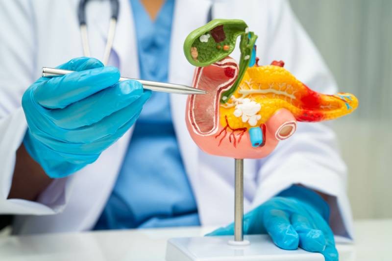 Cancer du pancréas : symptômes, causes, stades et espérance de vie ...