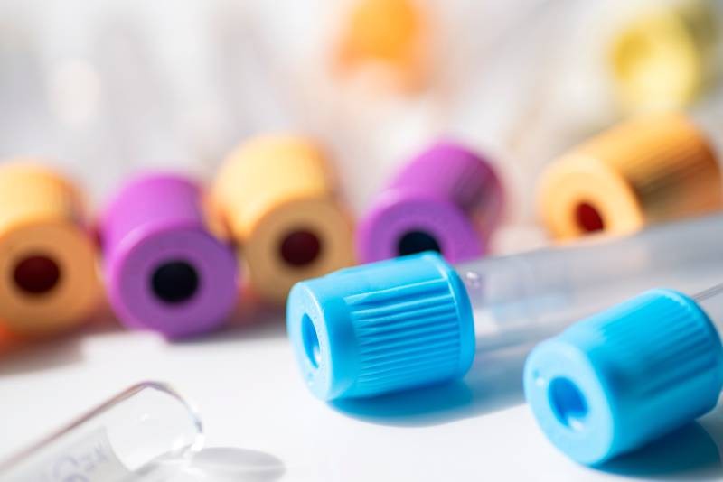 VGM : définition, taux élevé et bas | Charles.co