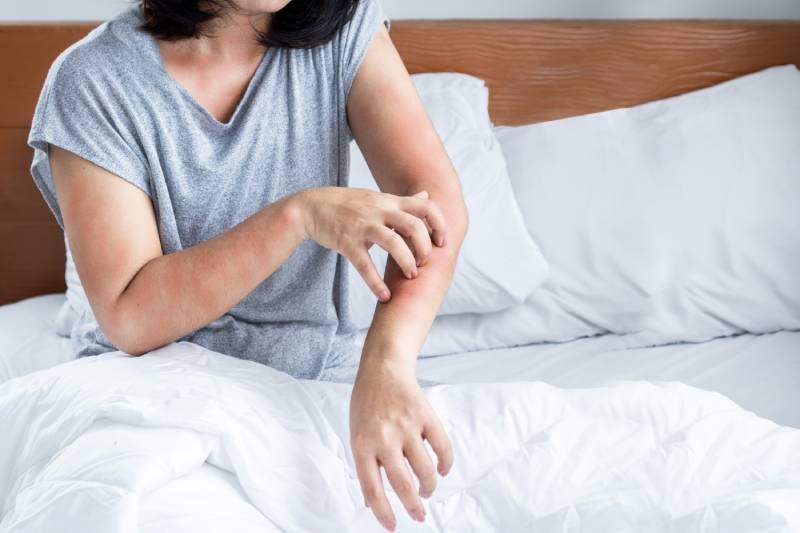 Teigne : symptômes, traitements et durée de contagion | Charles.co