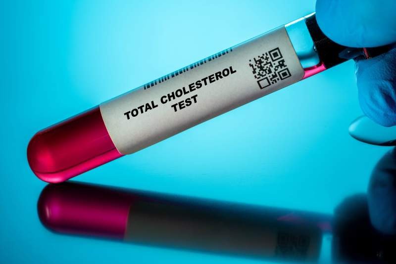 Cholestérol total : définition, haut, bas, calcul | Charles.co