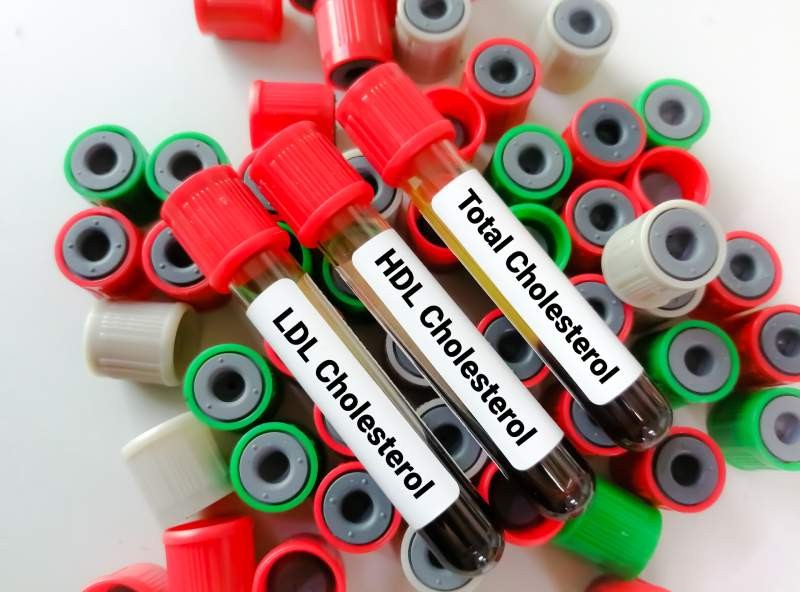 Cholestérol total : définition, haut, bas, calcul | Charles.co