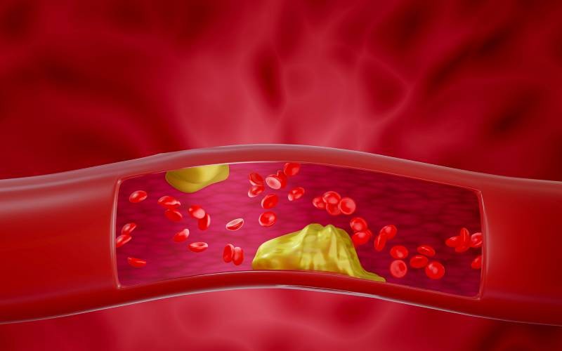 Mauvais cholestérol : définition et comment le faire baisser | Charles.co