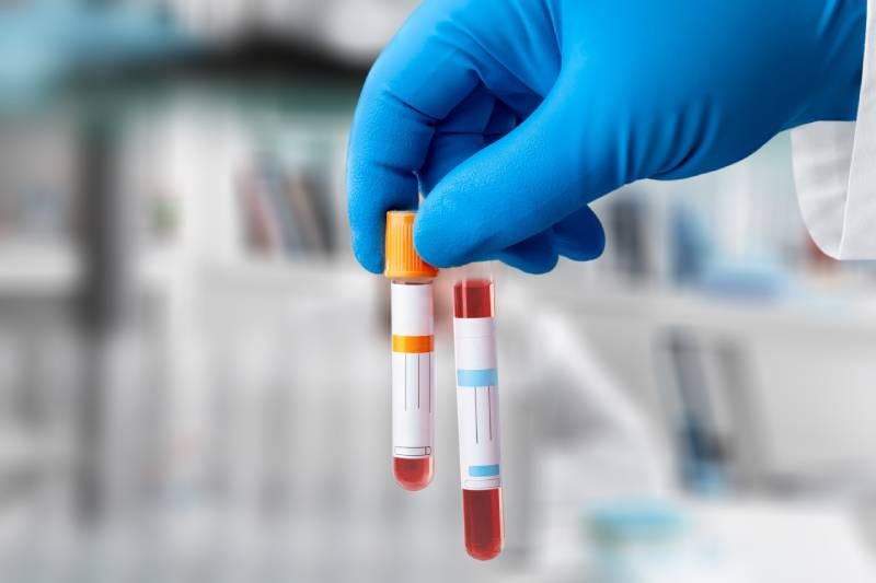 Bon cholestérol : définition, taux et comment l’augmenter | Charles.co