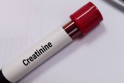 Créatinine : définition, taux normal et comment la mesurer | Charles.co