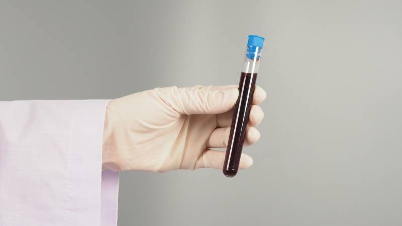 Cholestérol HDL bas : symptômes, causes, taux et que faire | Charles.co