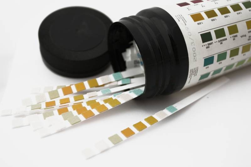 Bandelette urinaire : utilité, test et interprétation | Charles.co