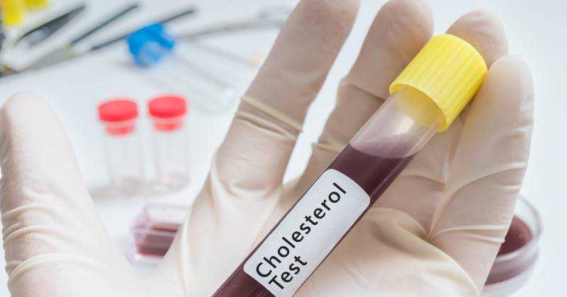 Cholestérol : définition, HDL ou LDL, alimentation et taux | Charles.co