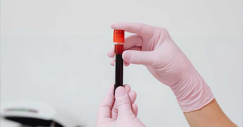 Bilan sanguin VIH : à quelle fréquence ? | Charles.co