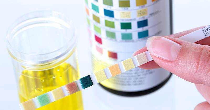 Bandelette urinaire : utilité, test et interprétation | Charles.co
