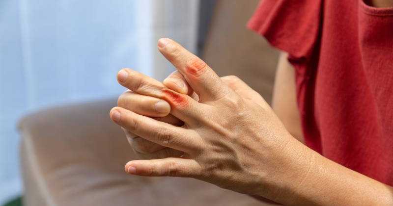 Acide urique élevé : symptômes, causes et solutions | Charles.co