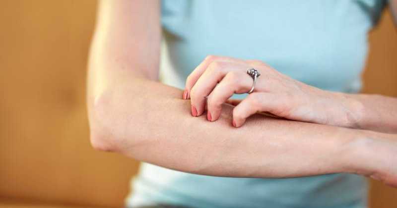 Piqûre d’araignée : symptômes, allergie et traitements | Charles.co