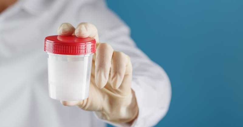 Comment se passe un spermogramme ? De la prise de rendez-vous aux ...